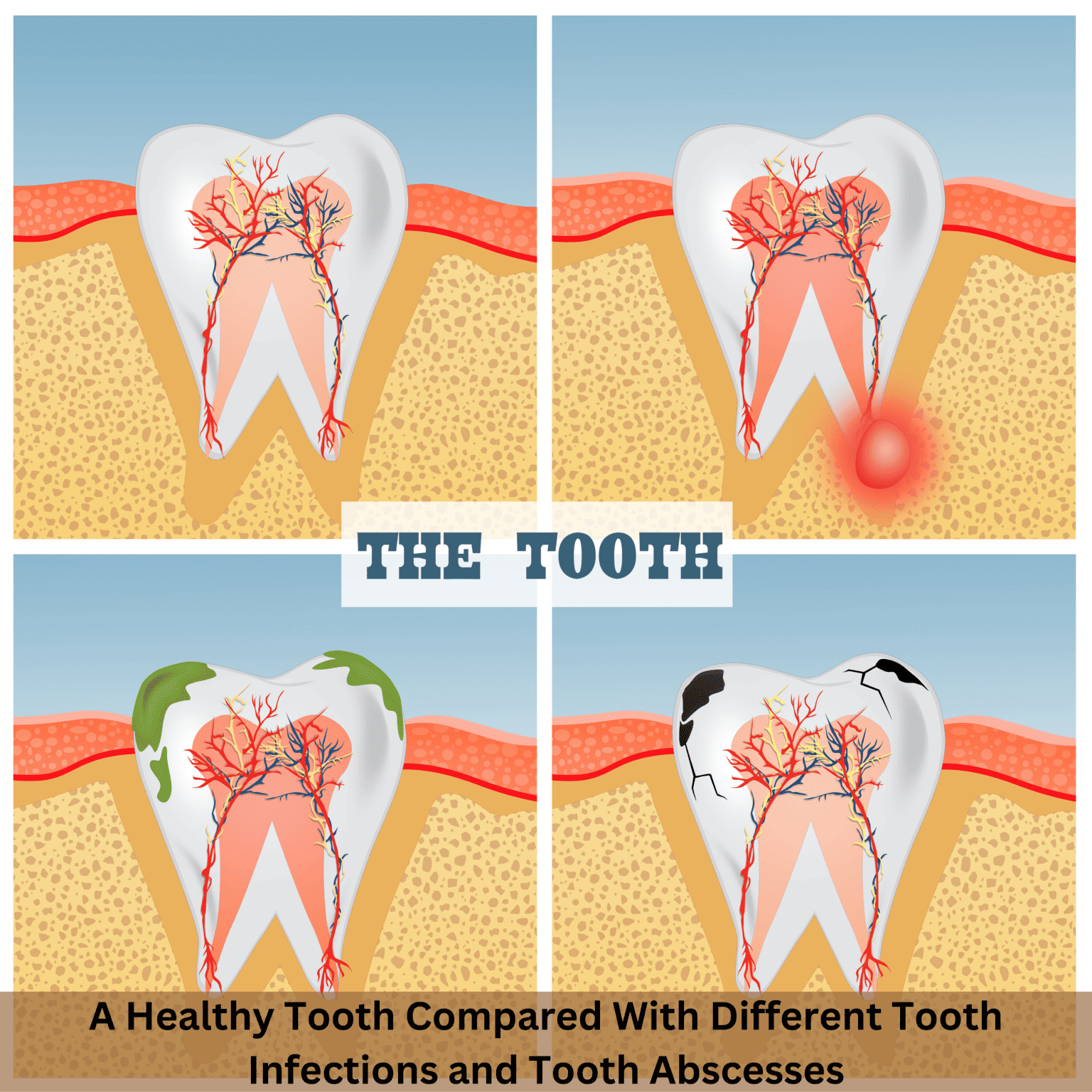 Dog Tooth Abscess: Unveiling Hidden Risks and Treatments - K9 Rocks